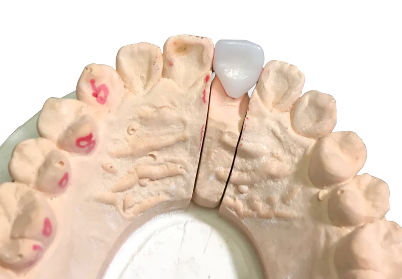 Dental Emax Milling Machine - Glorious Dental Materials Co. Ltd.