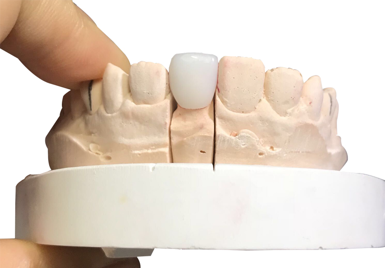 Dental Emax Milling Machine - Glorious Dental Materials Co. Ltd.